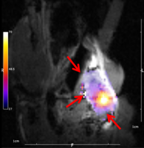 MR-guided Focused Ultrasound Therapy (MRgFUS) – Ferrara Lab